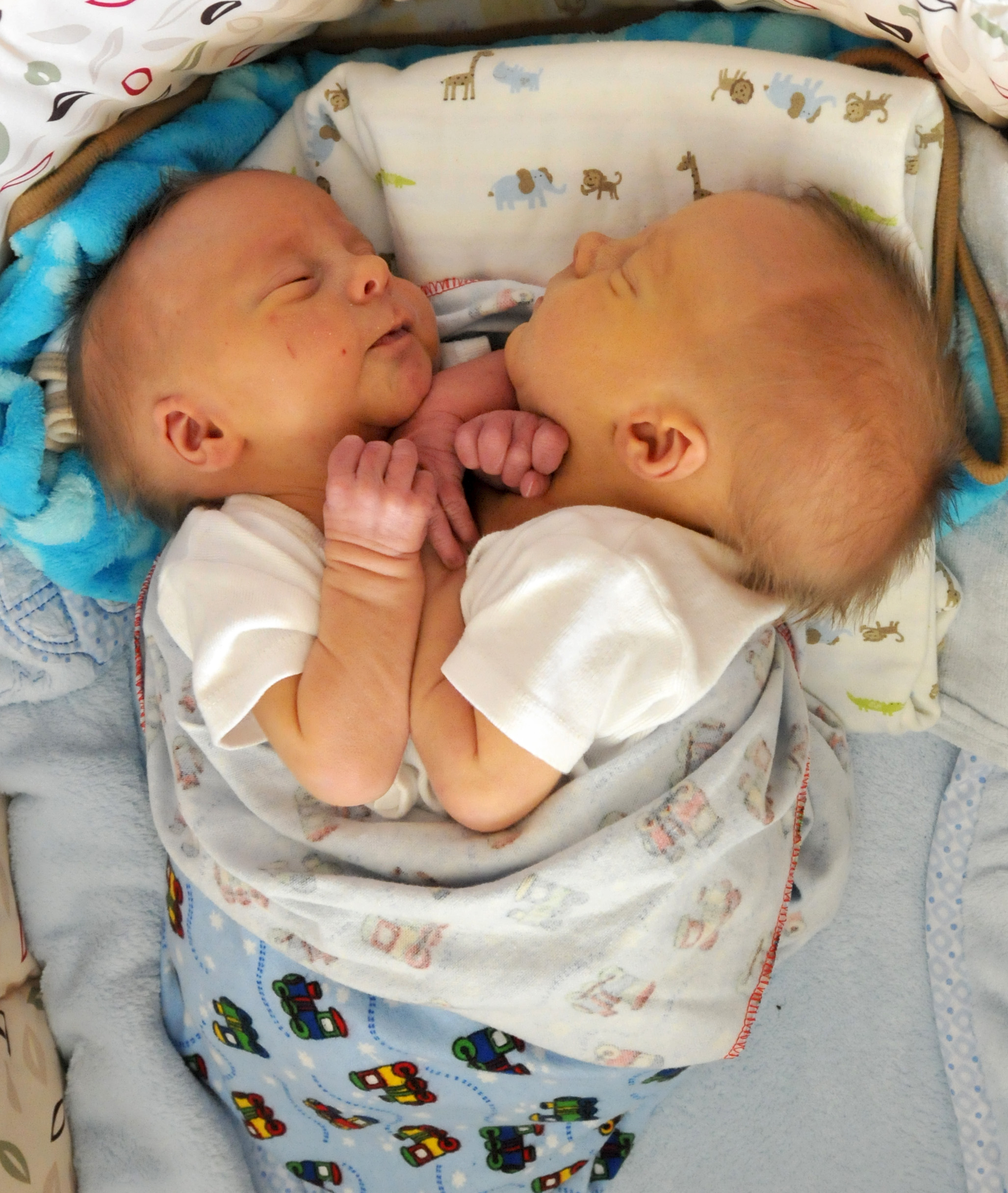 Conjoined twins ‘doing good,’ mother says | Communications at Large ...